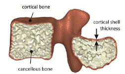 how can i shell body on countour of a solid body divide it into two ...