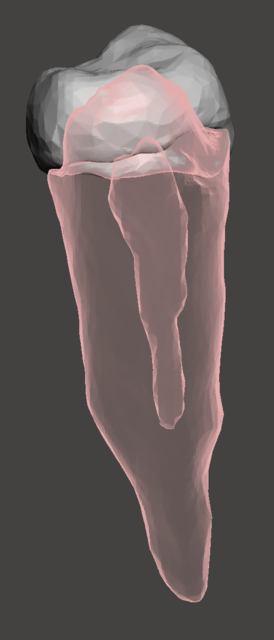 Overview And Histology Of Maxillary Bone A Rendered 3d Download