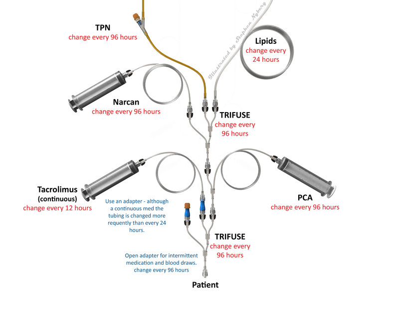 Central Venous Line (CVL) | 3D CAD Model Library | GrabCAD