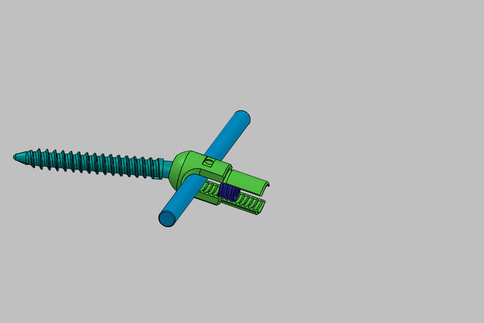 spinal bone screw